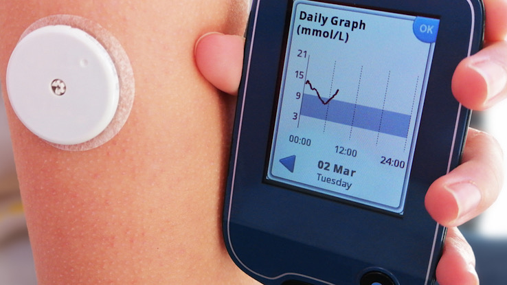 What Is Freestyle Libre? Continuos Glucose Monitoring System
