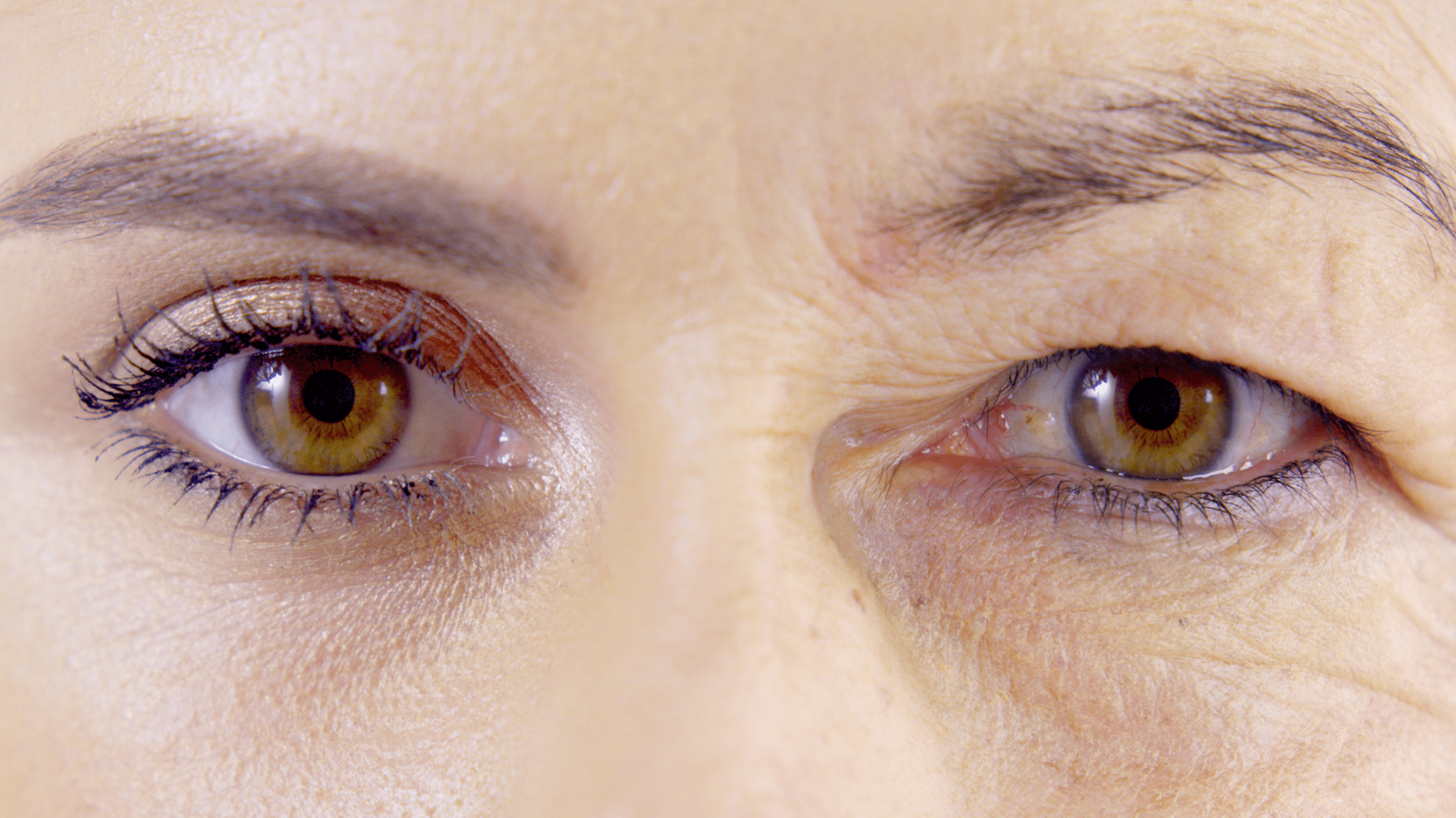 Saggy Skin: Causes and How to Tighten It Without Surgery